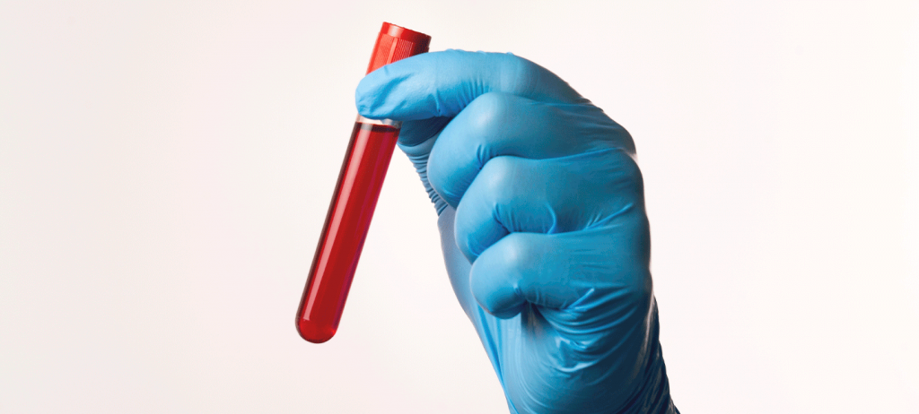 Private Blood Tests — In-clinic & home testing kits